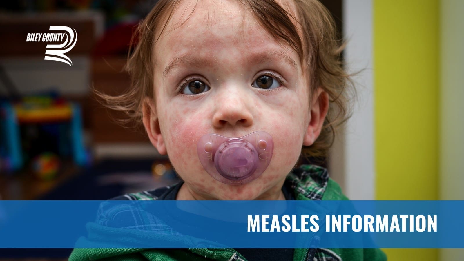 KDHE Creates Measles Dashboard for Updates | KCLY Radio